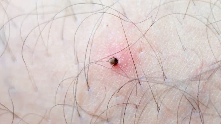Tick Bites in Australia: Everything You Need to Know | STC